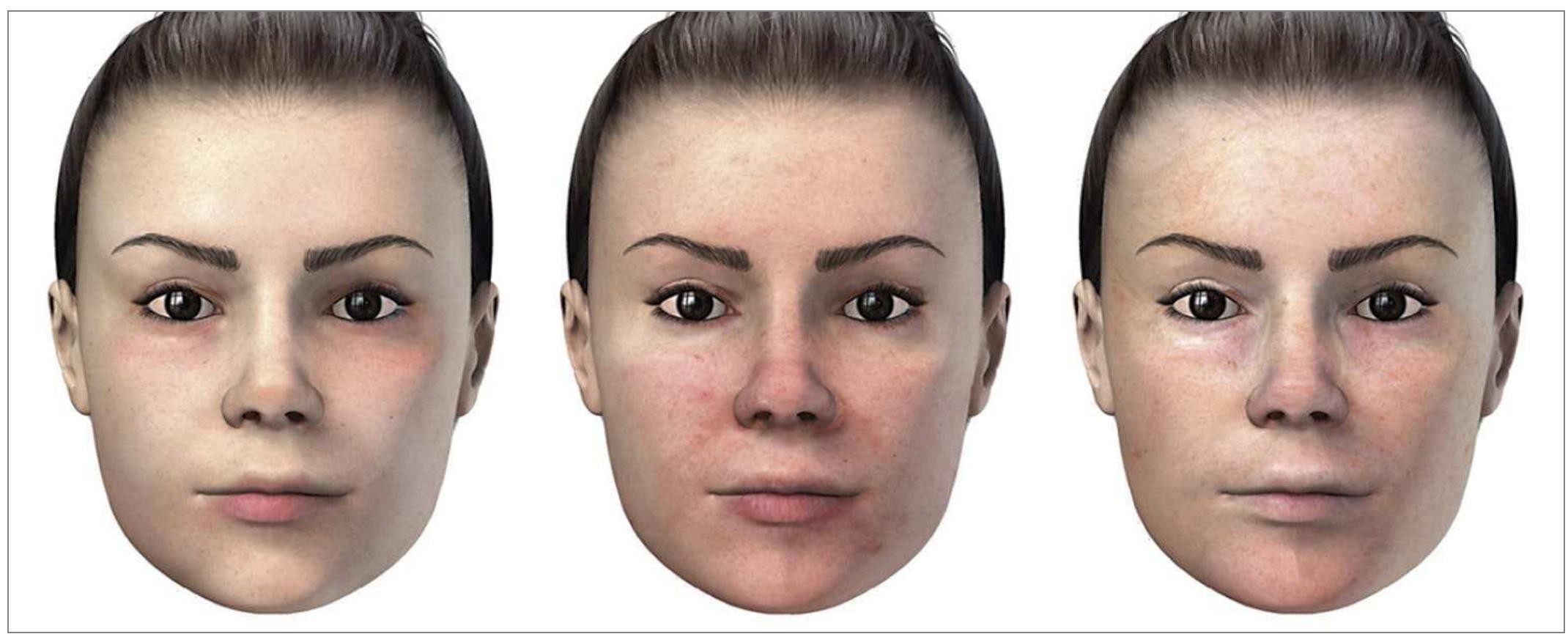 Skin tone and impaired wound healing [64]. these features