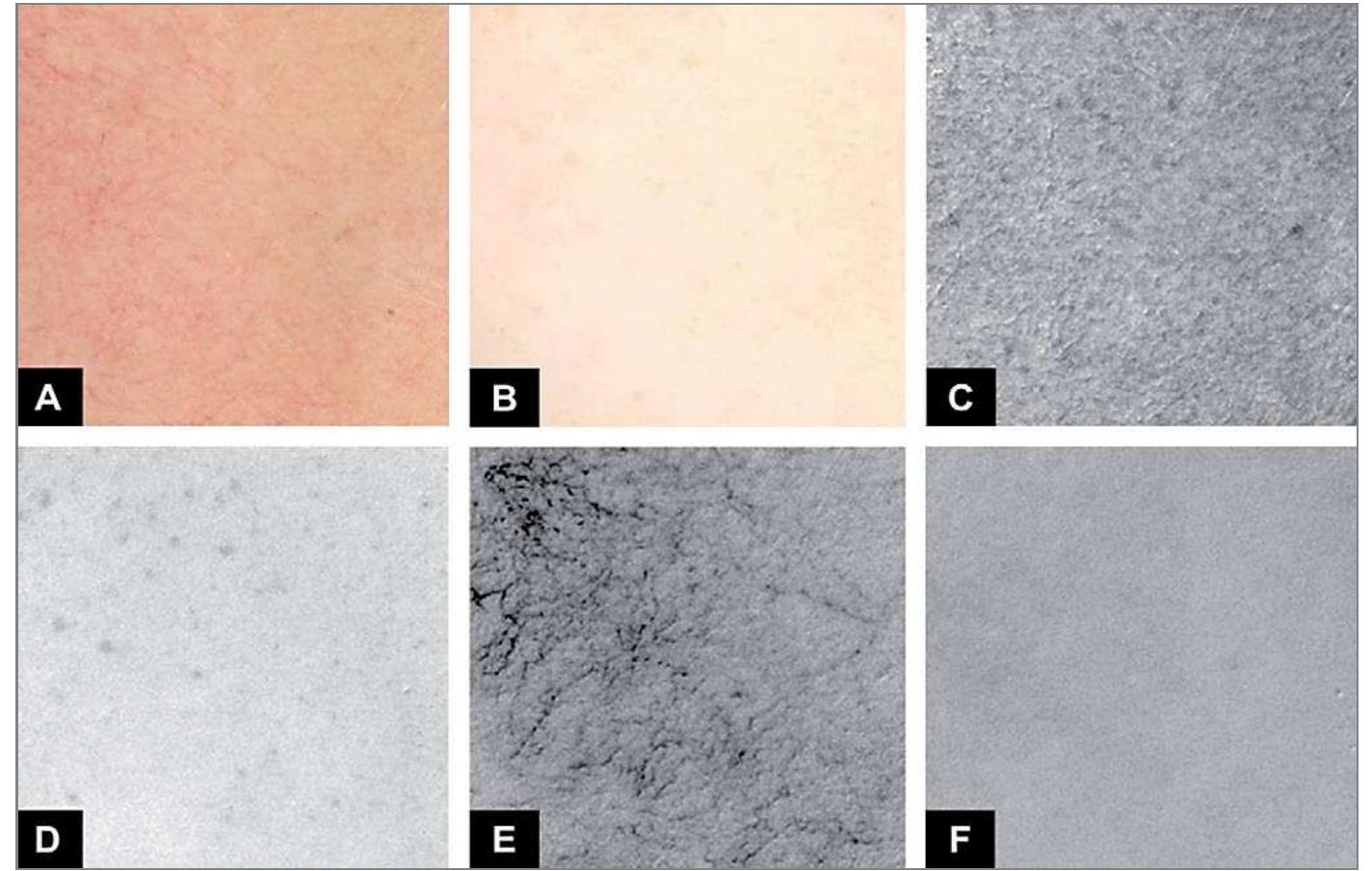 It is possible that diverging preferences exist for male