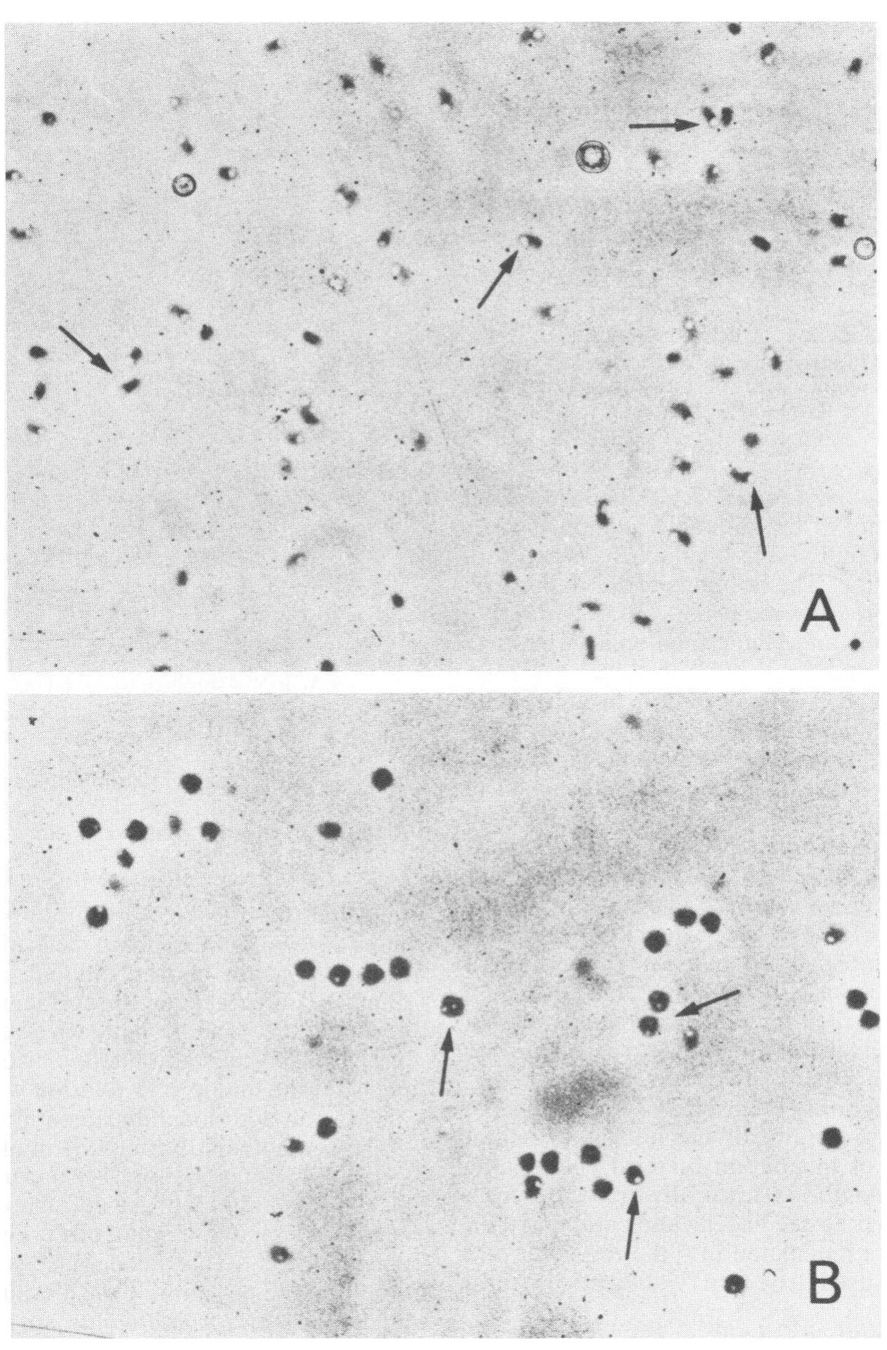 Phase-contrast micrograph of bdellovibrio sp. strain cp1
