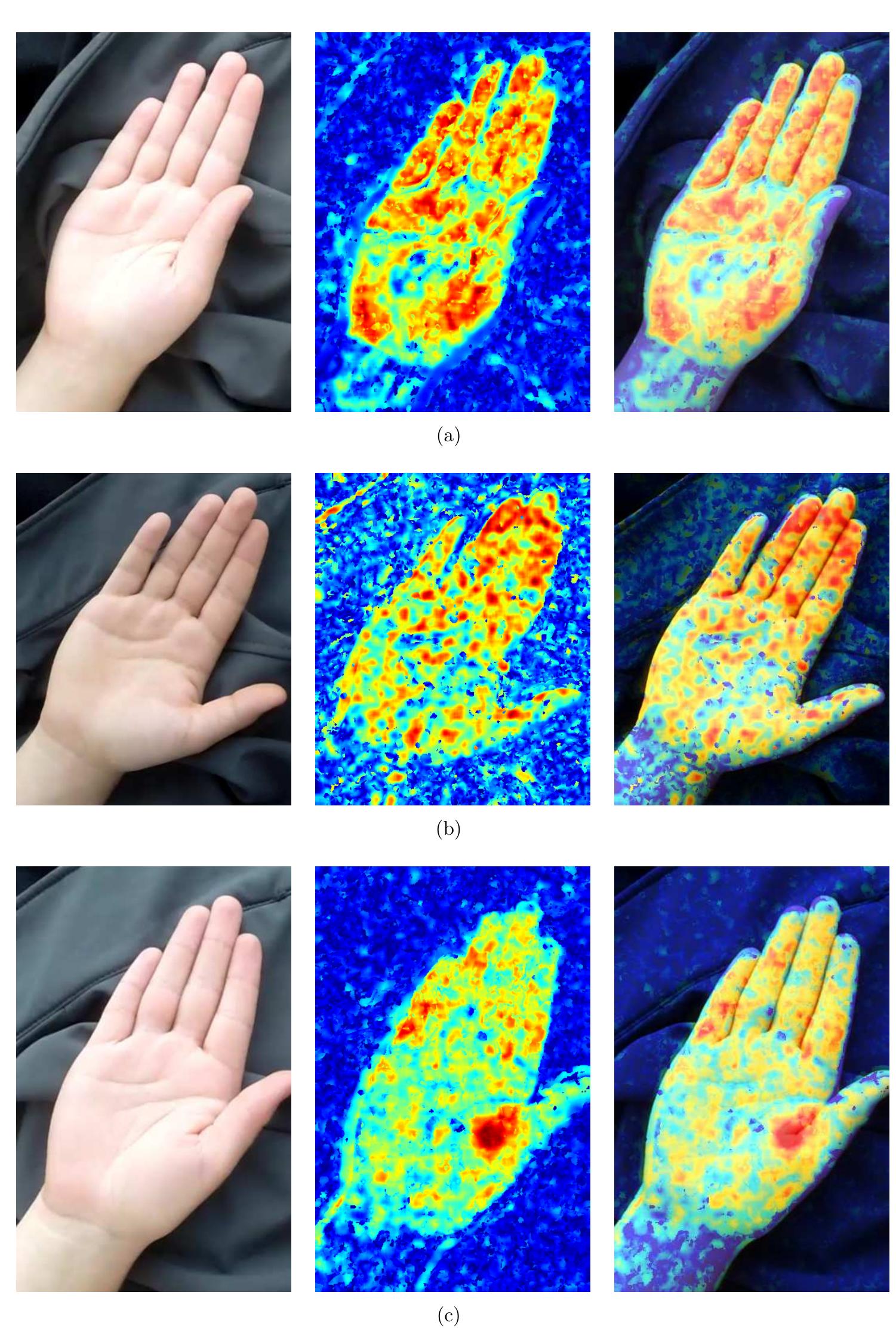 16: three examples of a heart rate intensity map for a hand