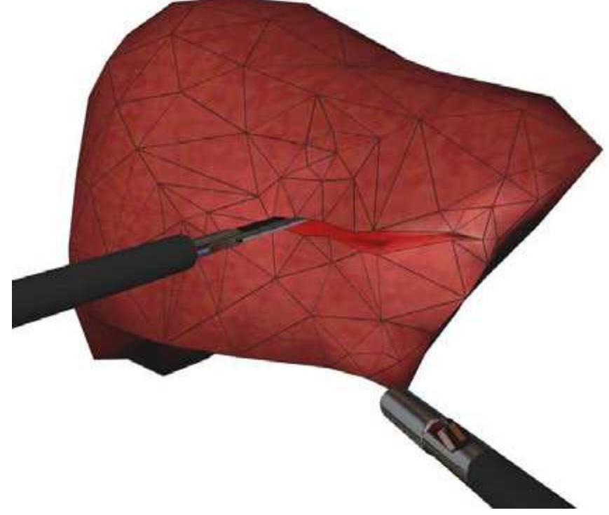 Adaptive soft tissue modelling with cutting and grasping.