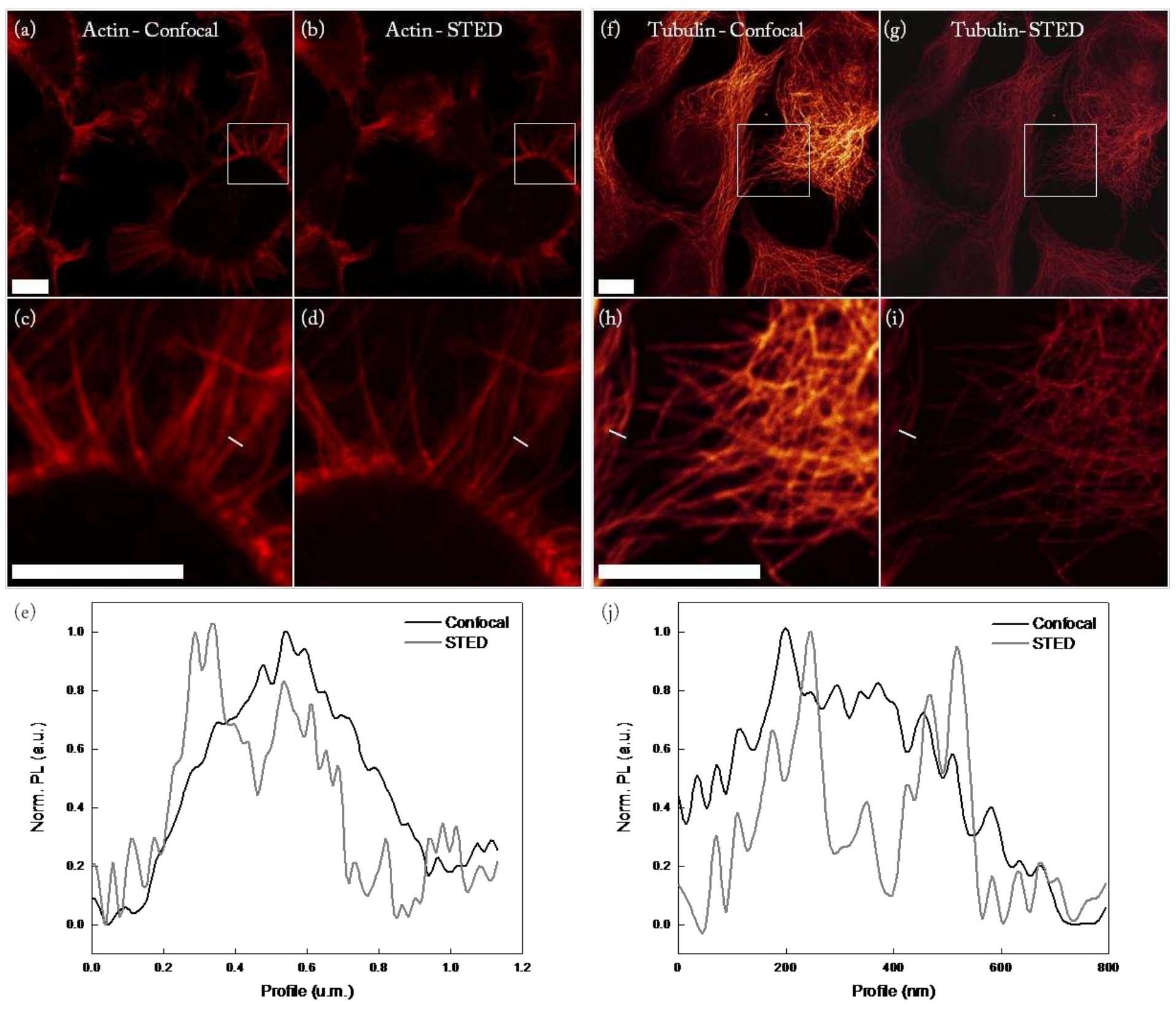 Comparison of sted and confocal images of immunolabeled