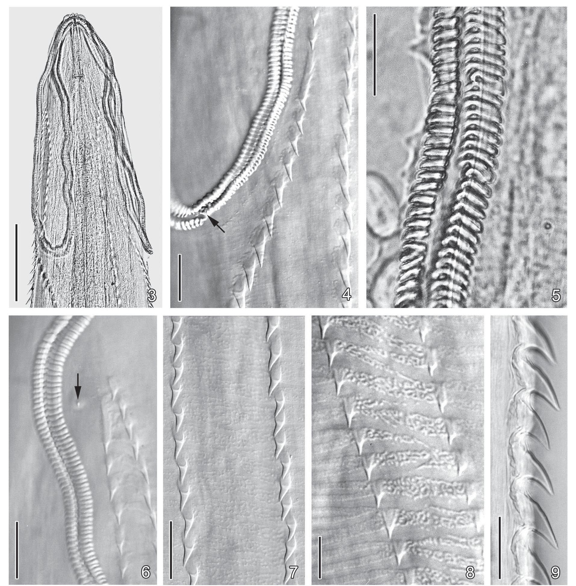 S 3-9. external morphology of echinuria uncinata: (3)