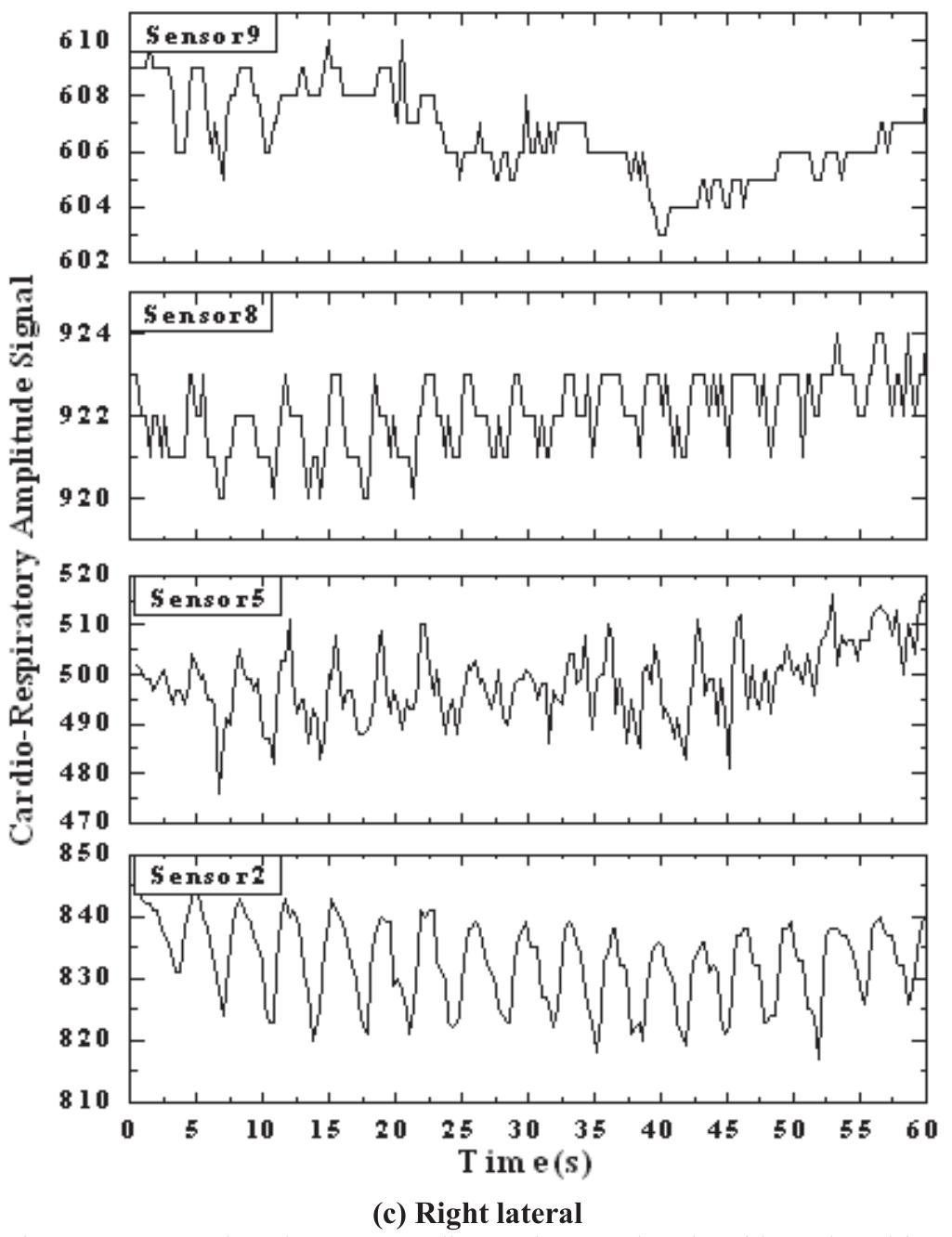 The experiment results are shown in fig 9 (a) for the supine