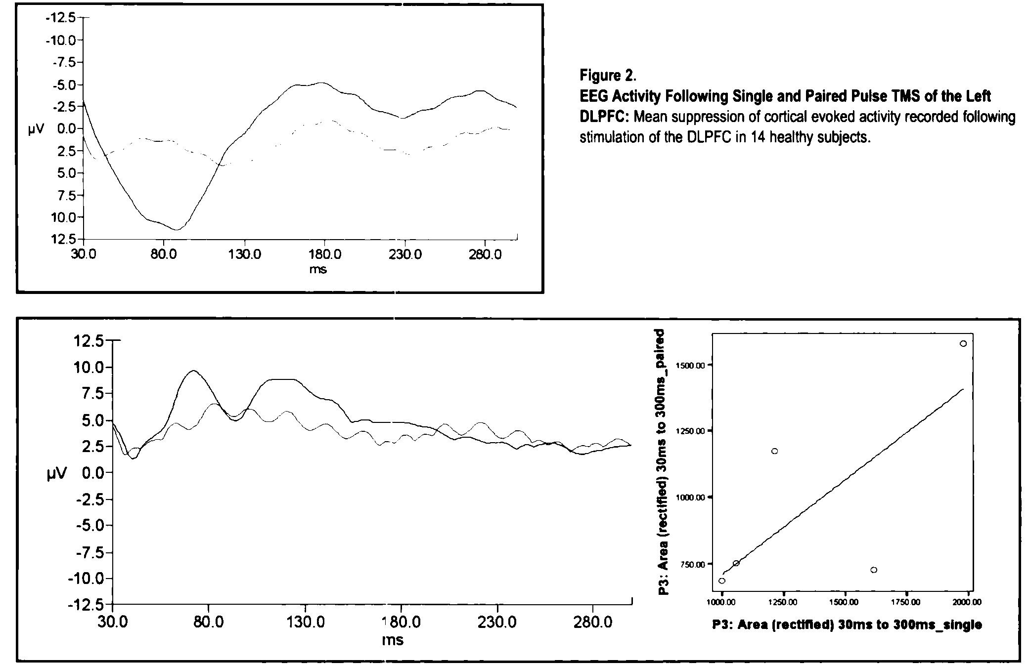 Eeg activity following single and paired pulse tms of the