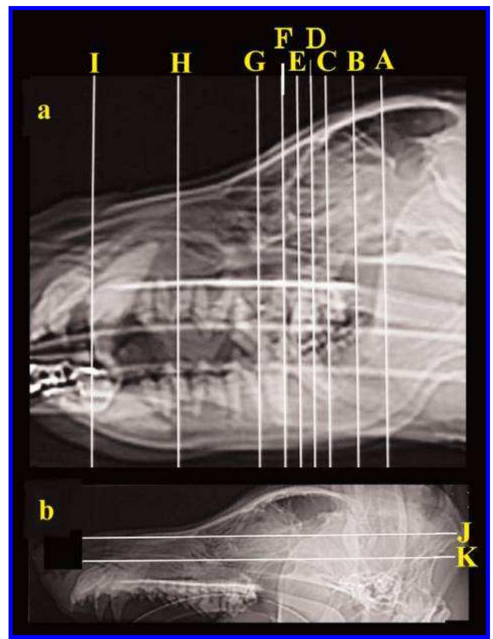 —lateral computed tomography (ct) scans of trans- verse (a)