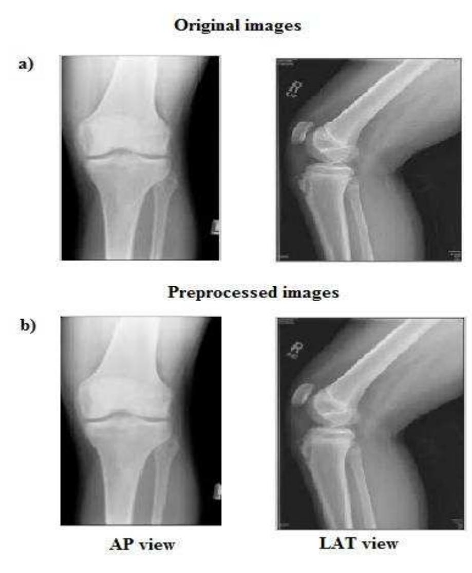 Figure 7 - Automatic Classification of Anterio-Posterior and