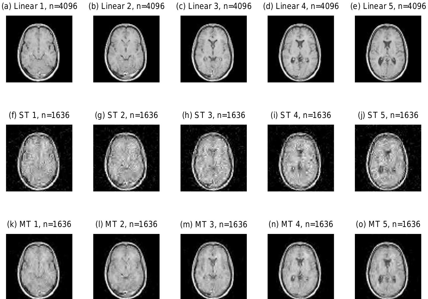 Reconstruction of mri images with hybrid cs. (a-e) linear