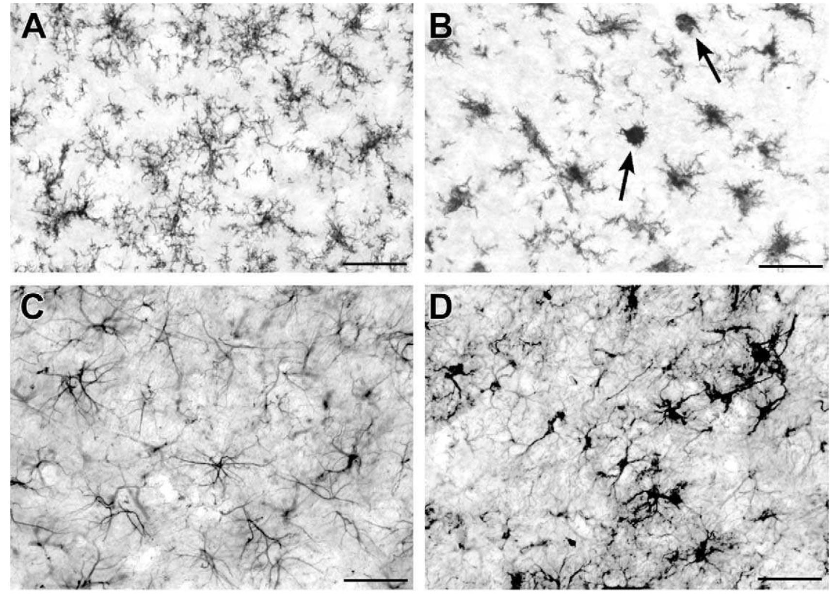 Immunohistochemistry of microglia and astrocytes. top panels