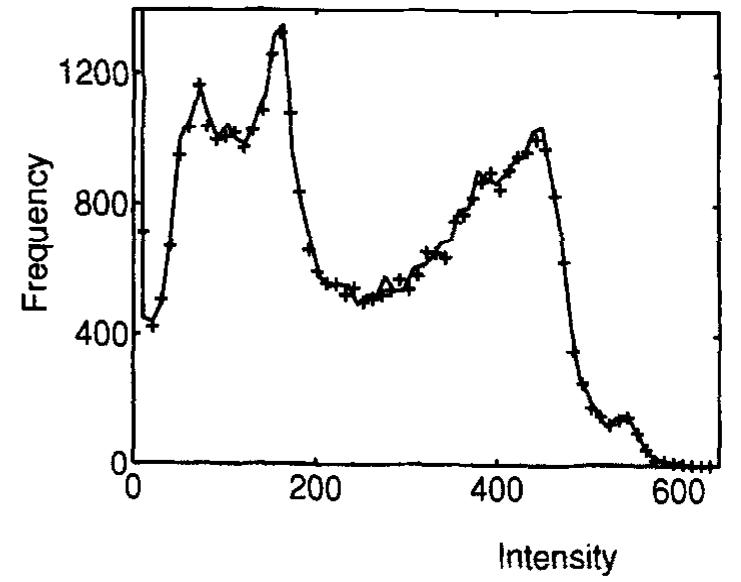 Histograms of the grey values of the knee images shown in