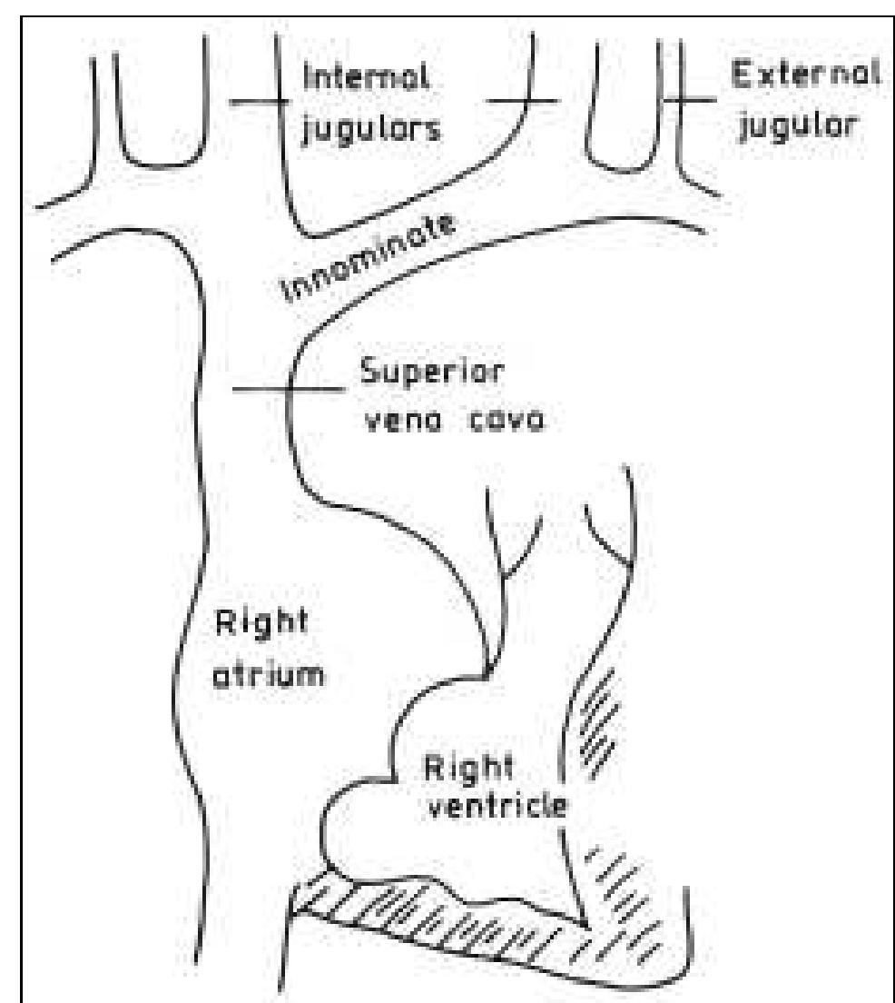 Figure 1 - from Jugular Venous Pulse : An Appraisal