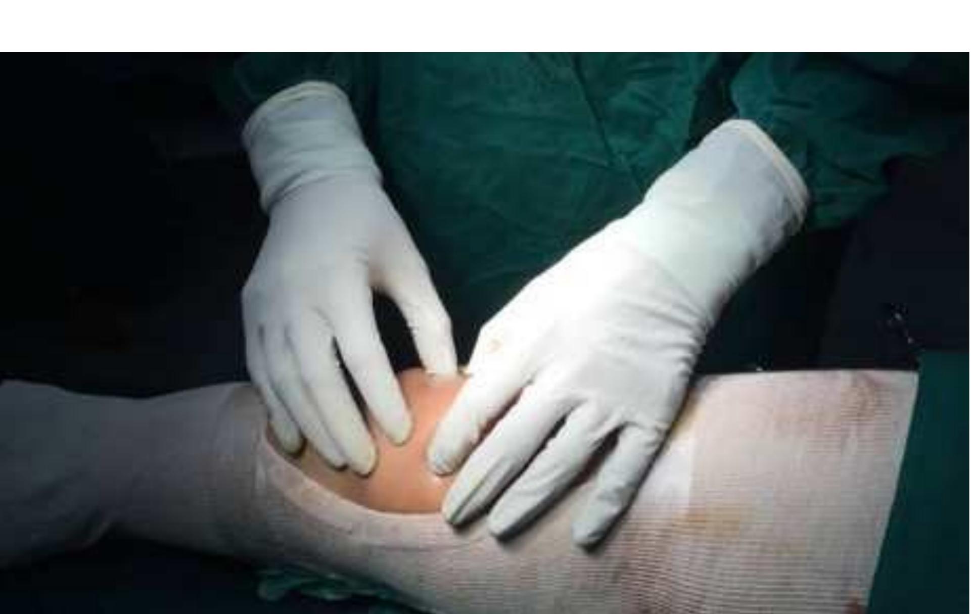 Figure 19 - Surgical approaches to the knee joint