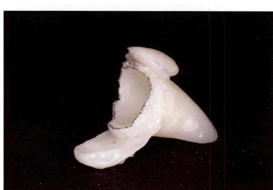 Figure 6 - Biologically oriented preparation technique