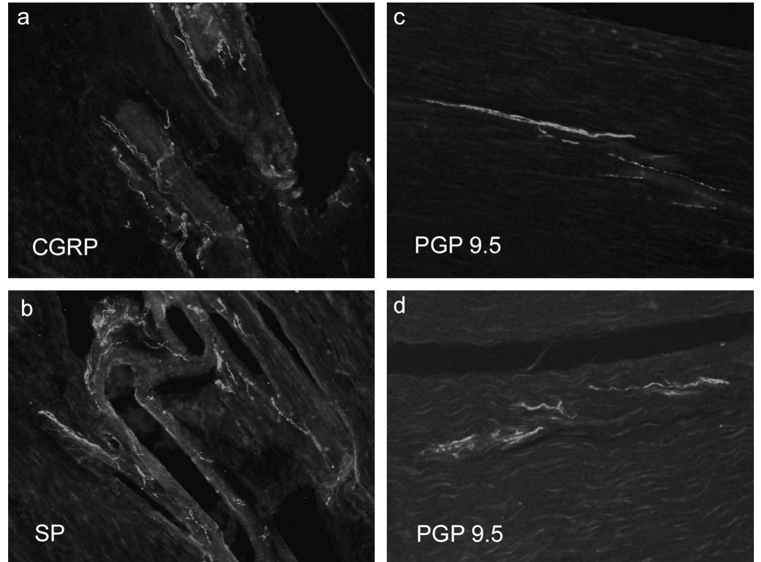 The nerve endings of b-fibers are autonomic and are mainly