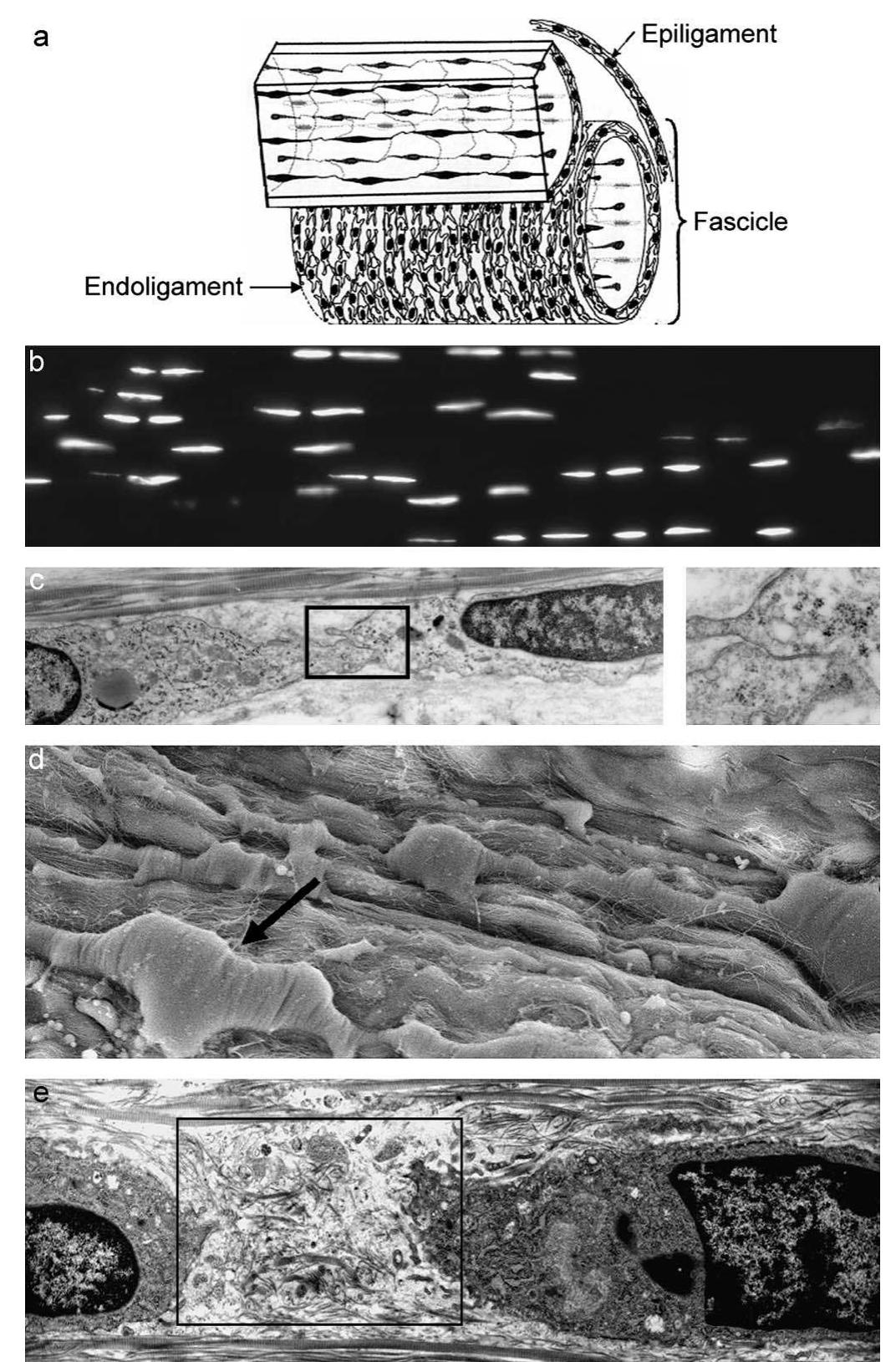 Figure 4 - Normal Ligament Structure, Physiology and