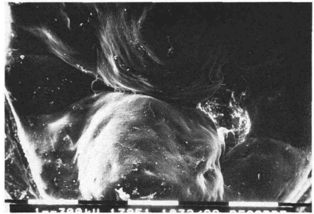 Sem view of the occlusal surface of the right second