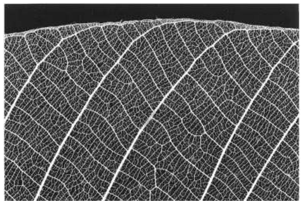 A network of thicker and thinner vascular stands describing