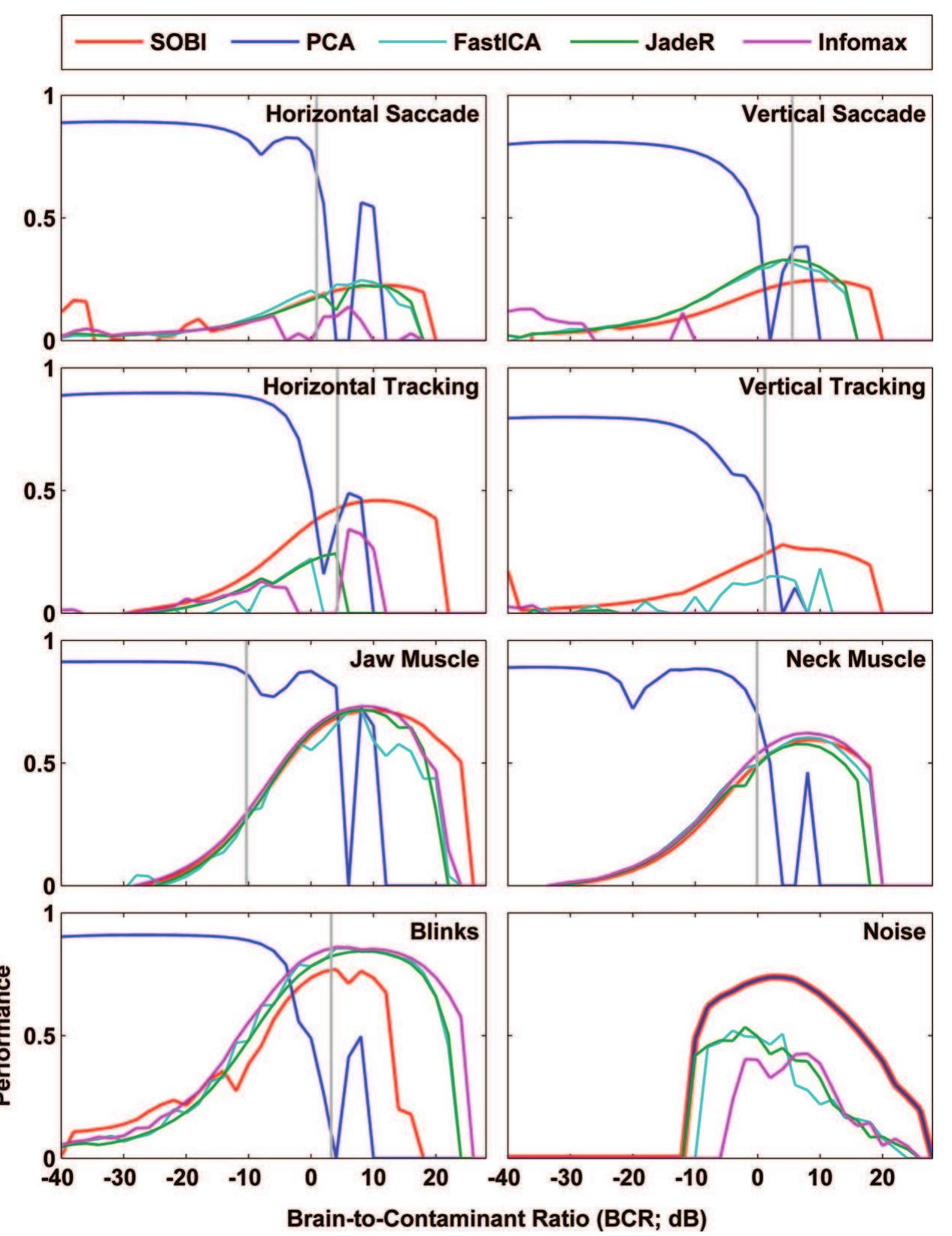 Figure 1 Removal Of Eeg Noise And Artefact Using Blind