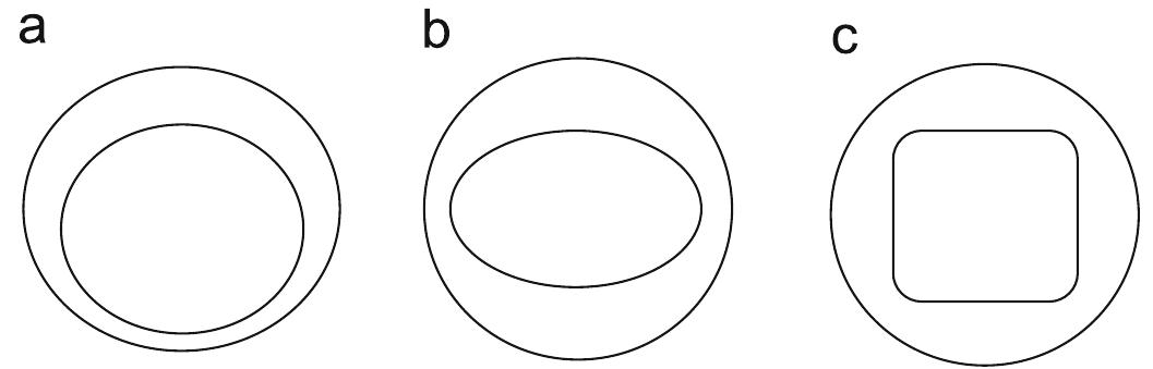 Types of wall thickness variation.