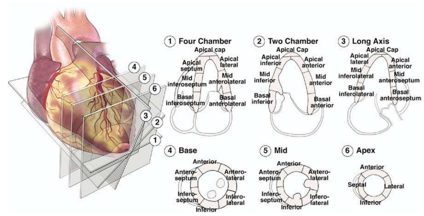 Segmental analysis of lv walls based on schematic views, in