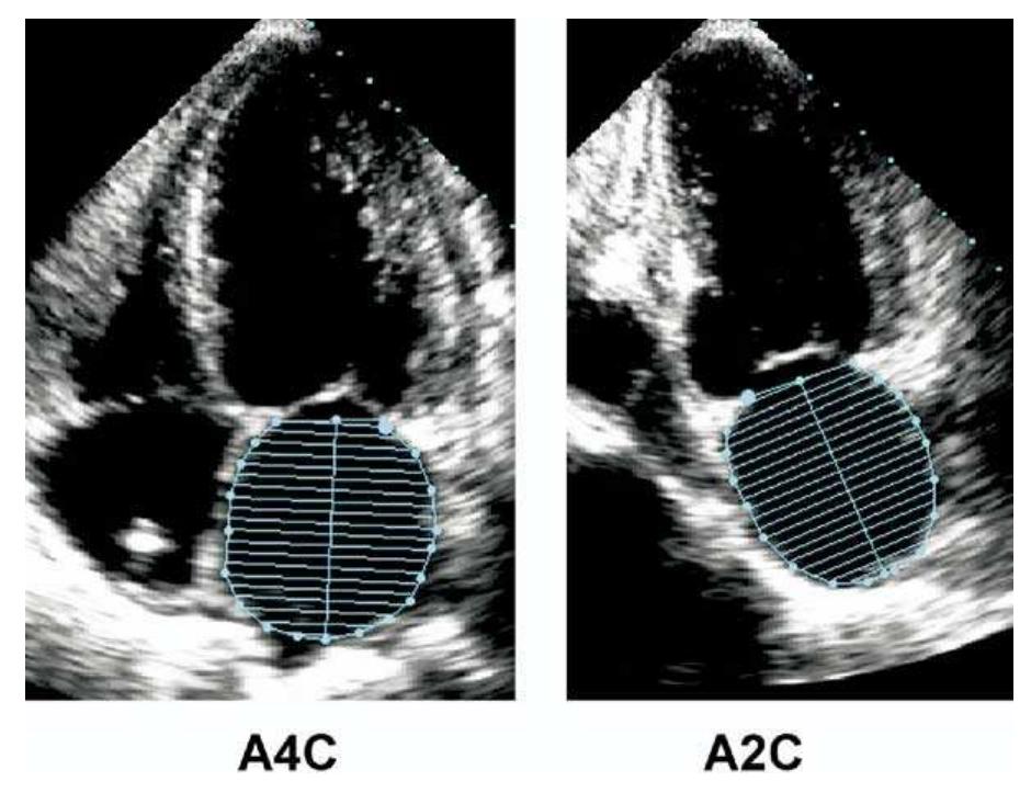 (PDF) Recommendations for Chamber Quantification: A Report from the ...