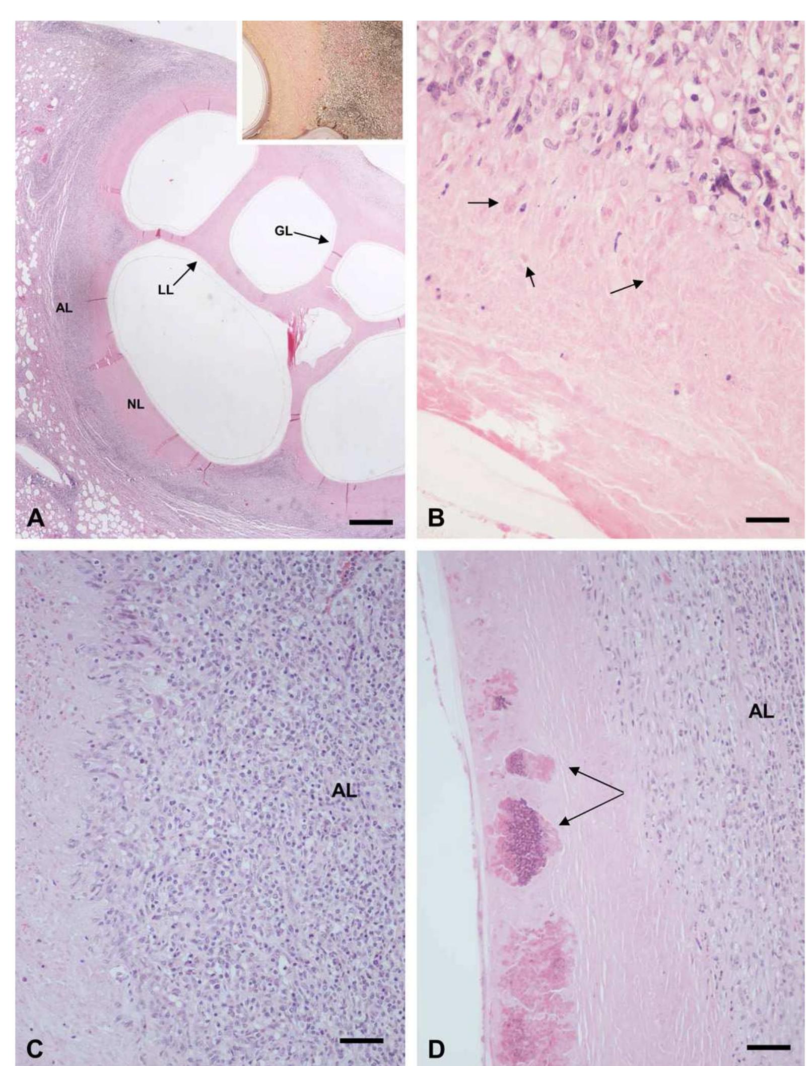 5. echinococcus granulosus cysts in the lung of'a sheep at