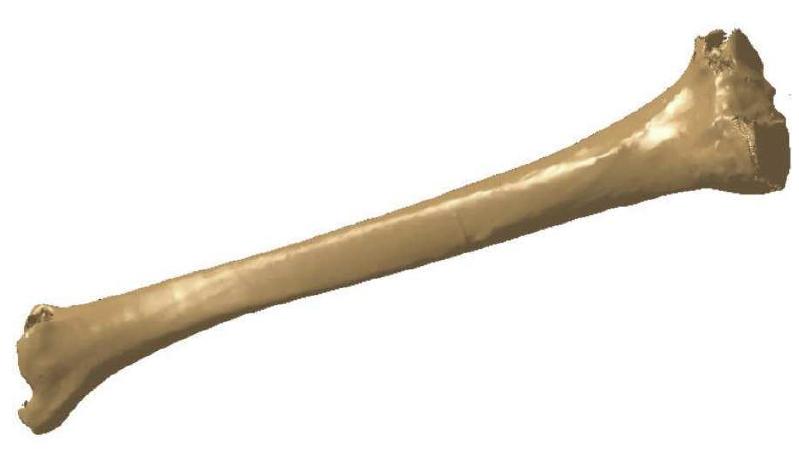 Polygonal model of tibia, with removed segments of
