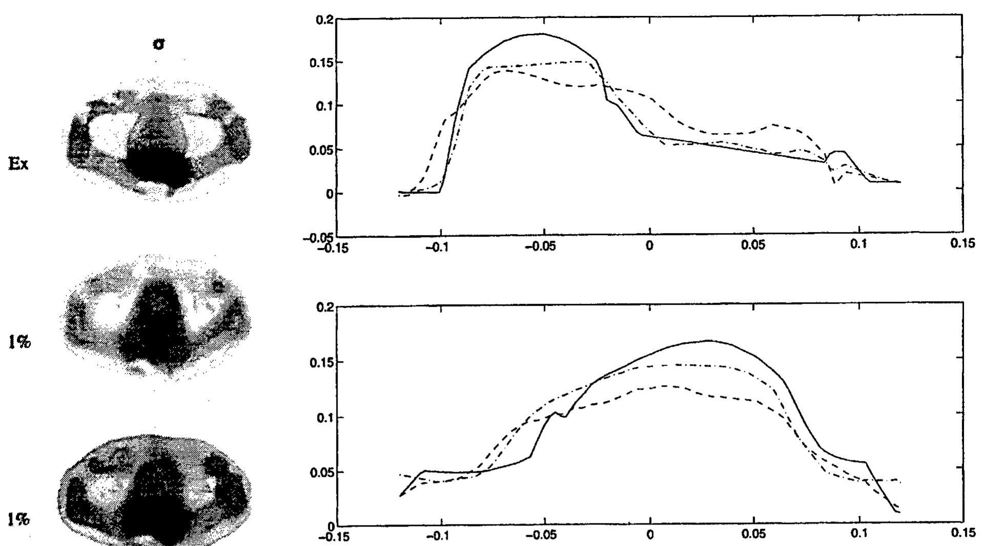Thermal imaging simulations in a ct-scan model with and