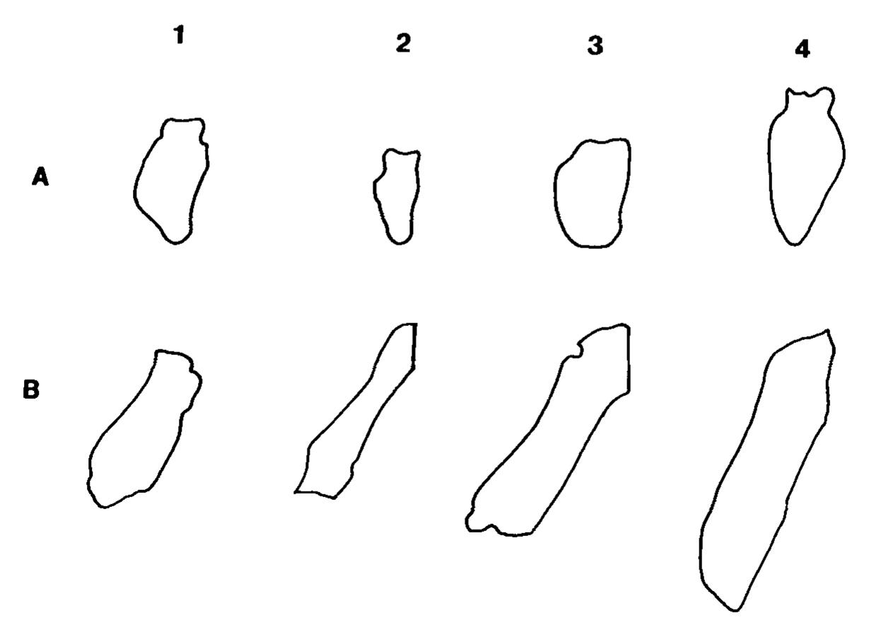 Transverse and coronal sections of the mandibular corpus: