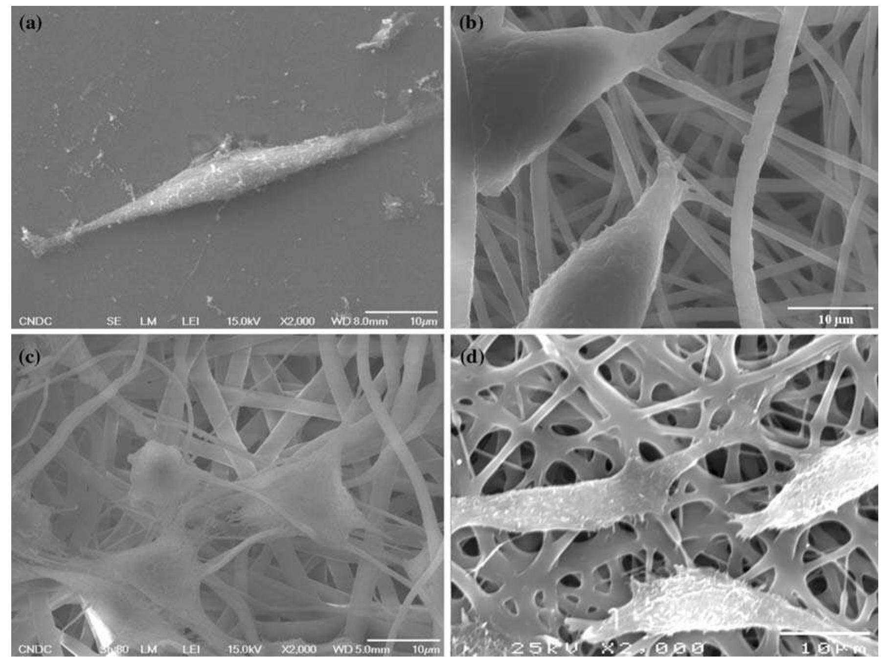 Sem morphology of fibroblast cells grown on the control (a),