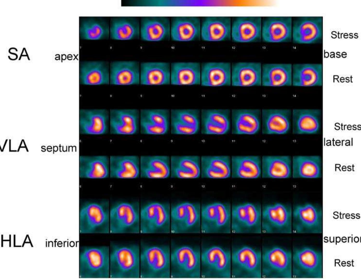 Display of the stress and rest studies with all slices in