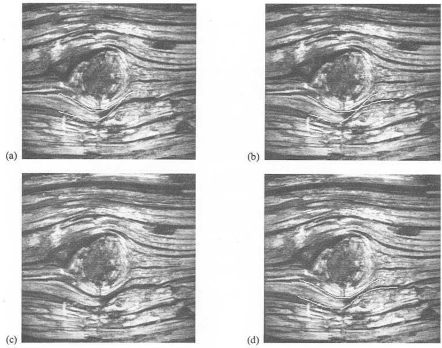(PDF) Snakes: Active contour models