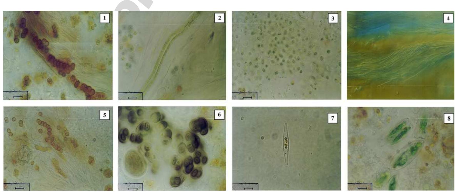 Figure 6 - from Microbial community of cyanobacteria mats in