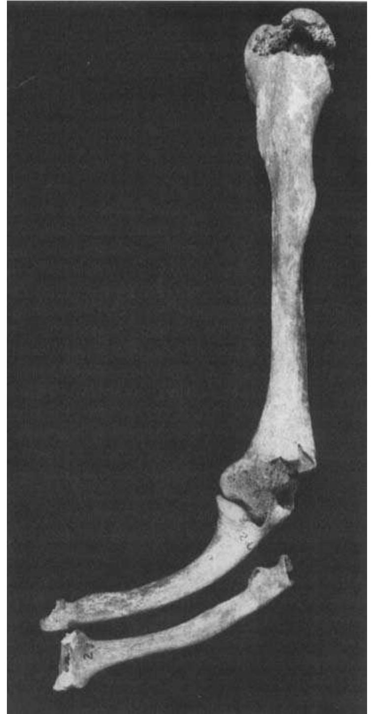 Left humerus, radius, and ulna of romito 2. note relatively