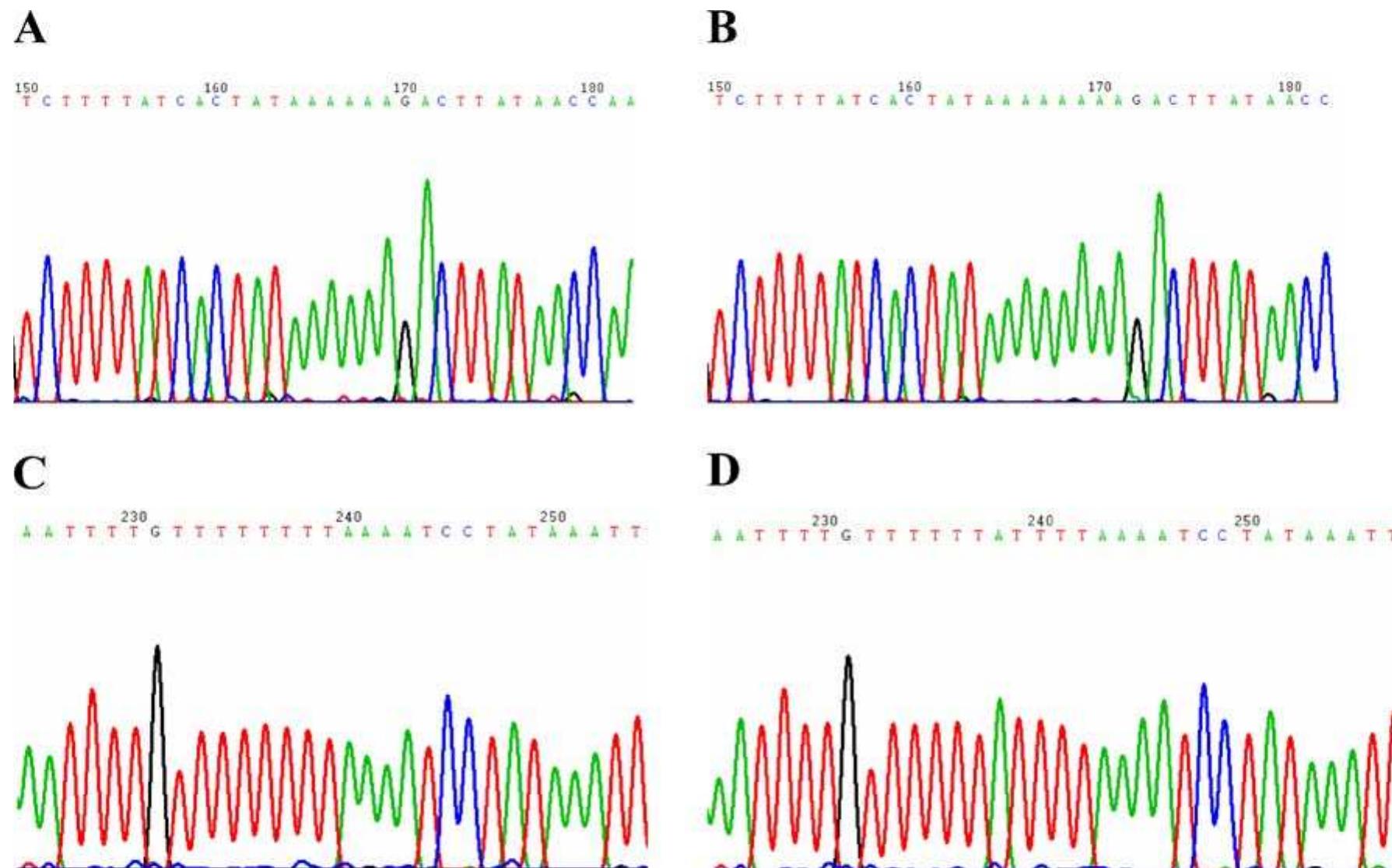 Staphylococcus aureus, clostridium perfringens, strepto-