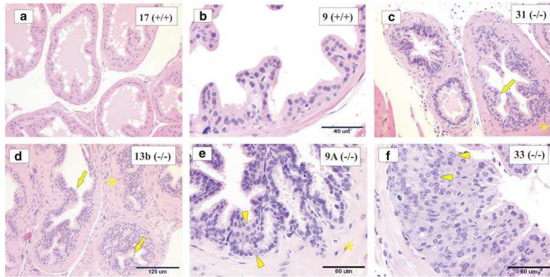 Histology of the prostates of usf2-null mice. tissues were