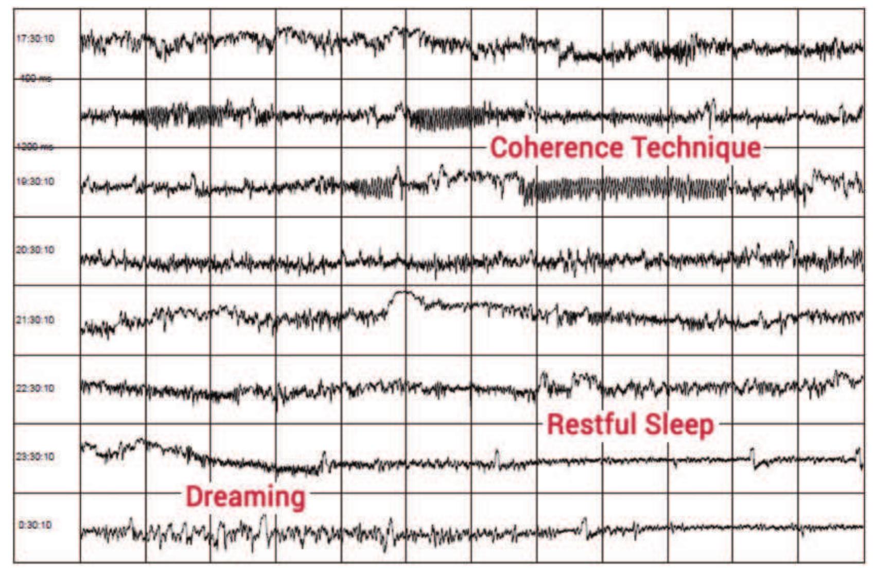 3. an example of the heart-rate tachogram, a plot of the