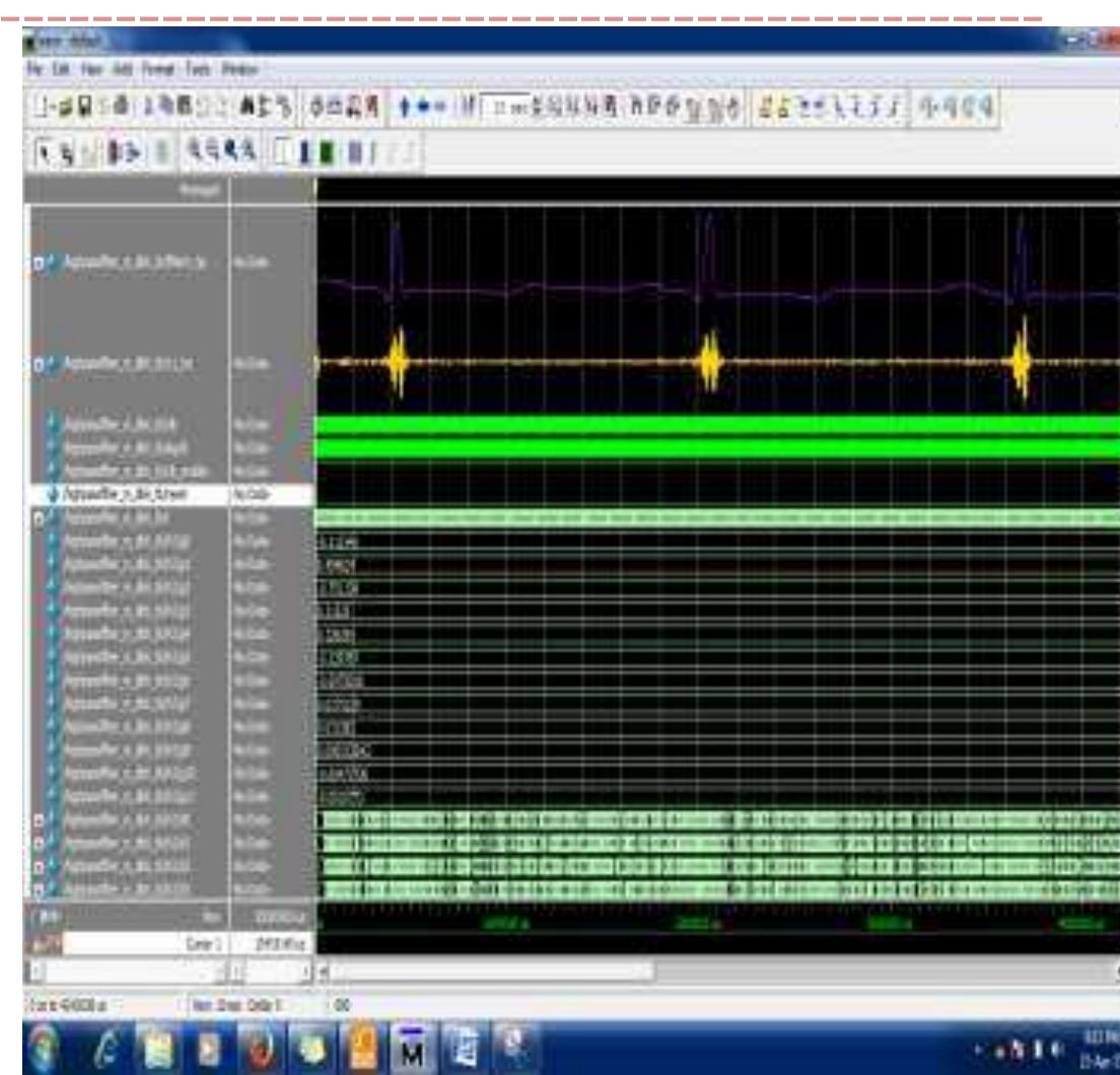 High-pass filter module simulation