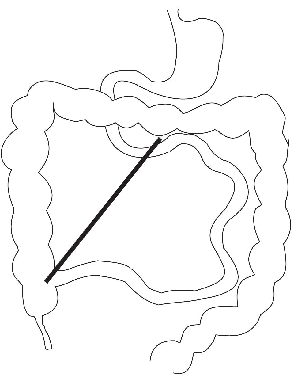 Normal anatomy: state of the abdomen after complete