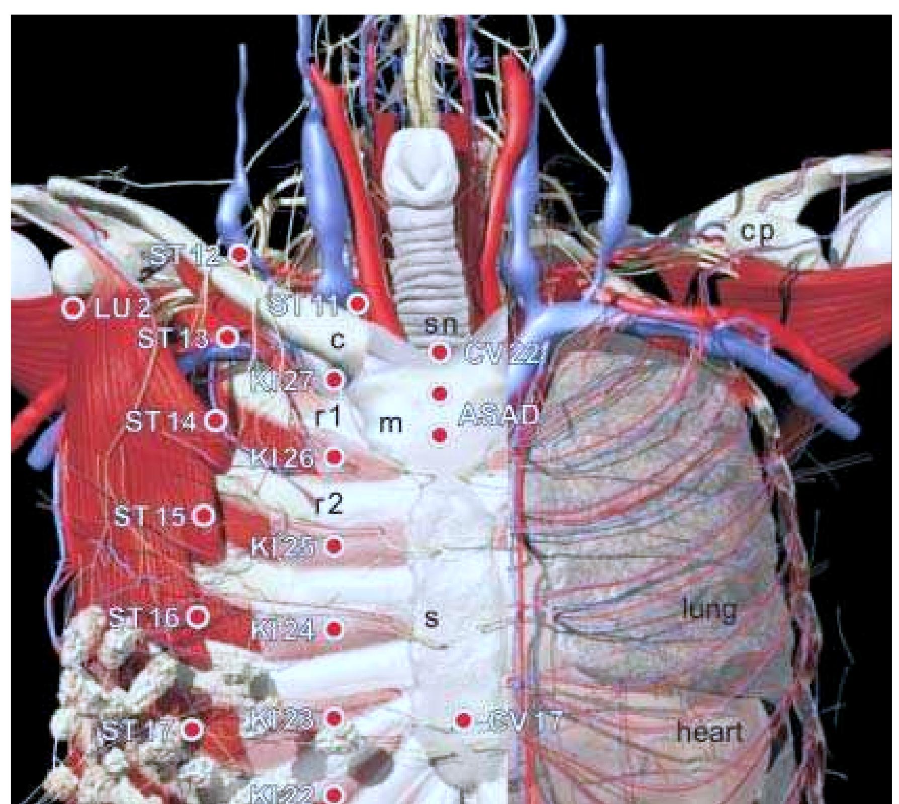 This is a split level view of the anterior aspect of the