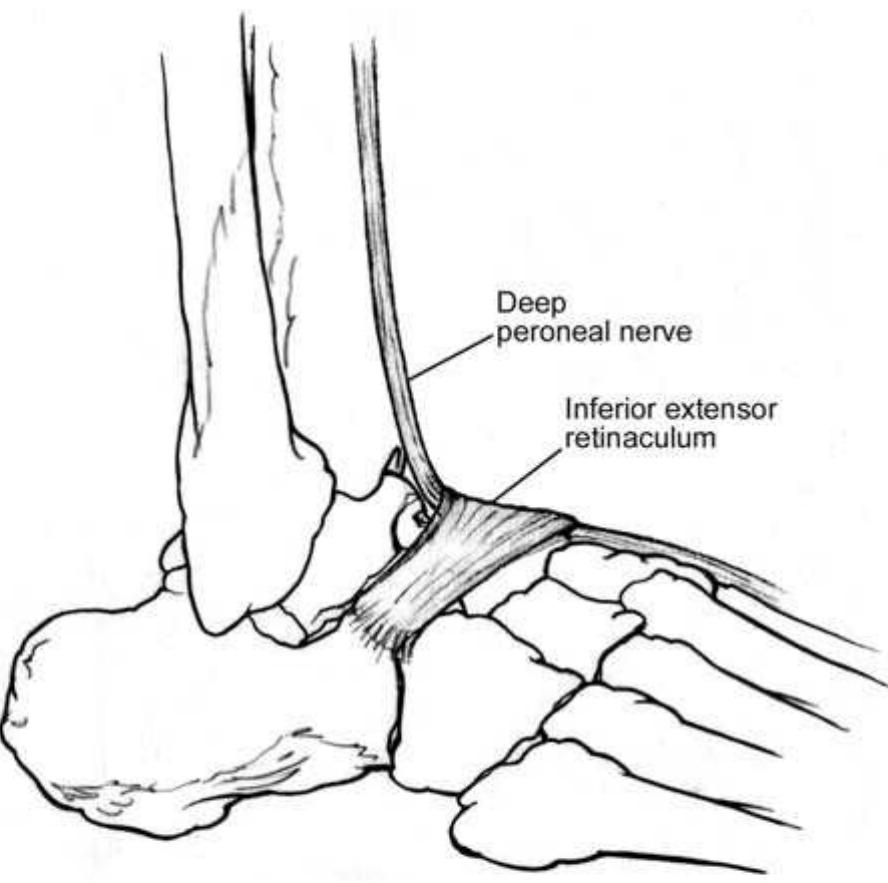4 anterior tarsal tunnel. the deep peroneal nerve passes