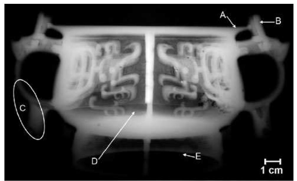X-ray radiographic image of the side view of the question-