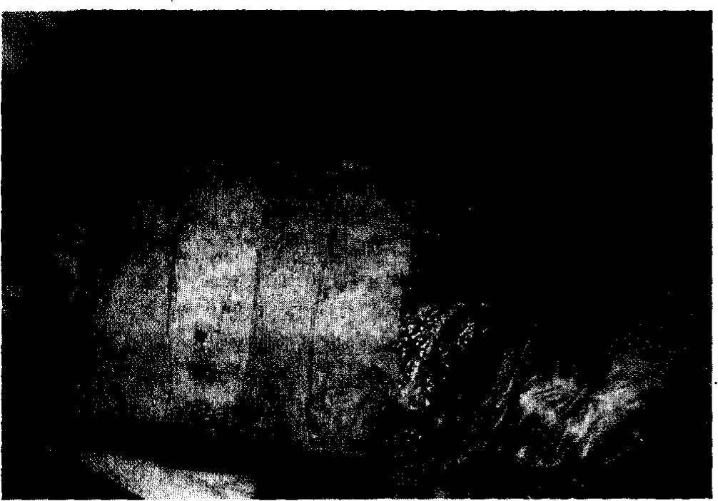Figure 2 - from Widely expanded postage stamp skin grafts
