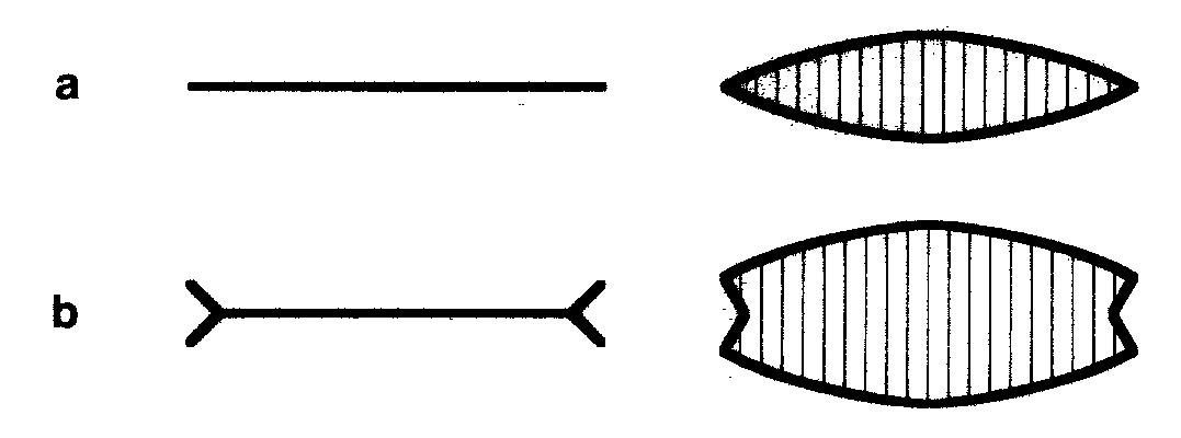 Diagram of two types of release-incisions of the same