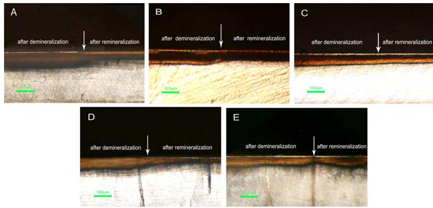 - polarised light microscopic pictures of enamel sections