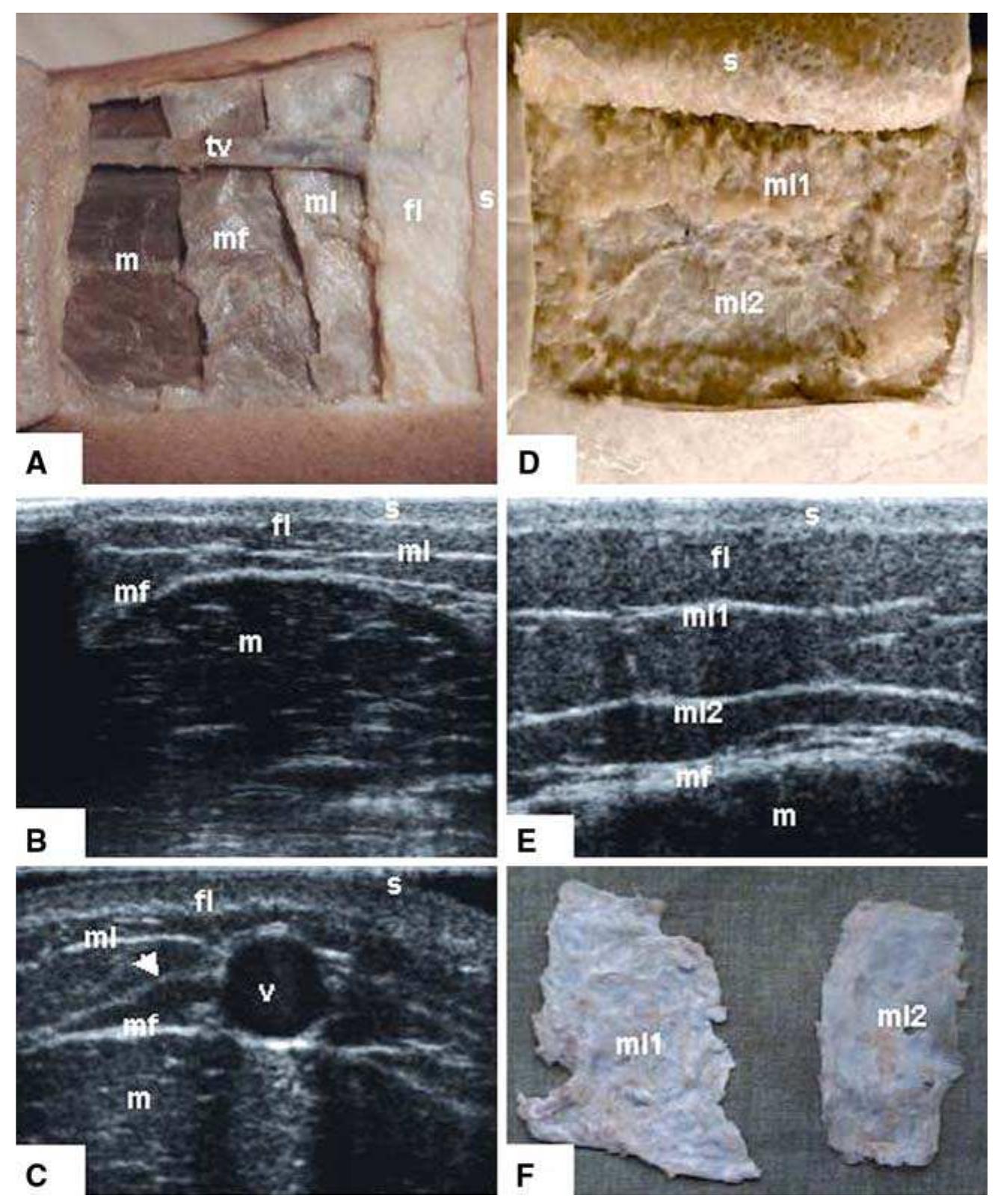 Cutaneous fatty layer (f1). in the posterior arm, two layers