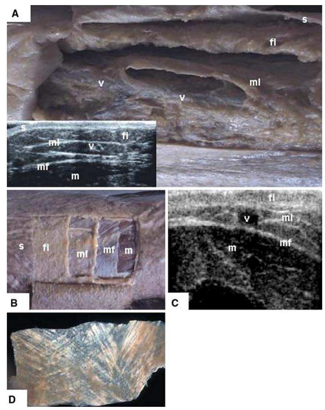 The platysma muscle (fig. 9a). the sternocleidomastoid