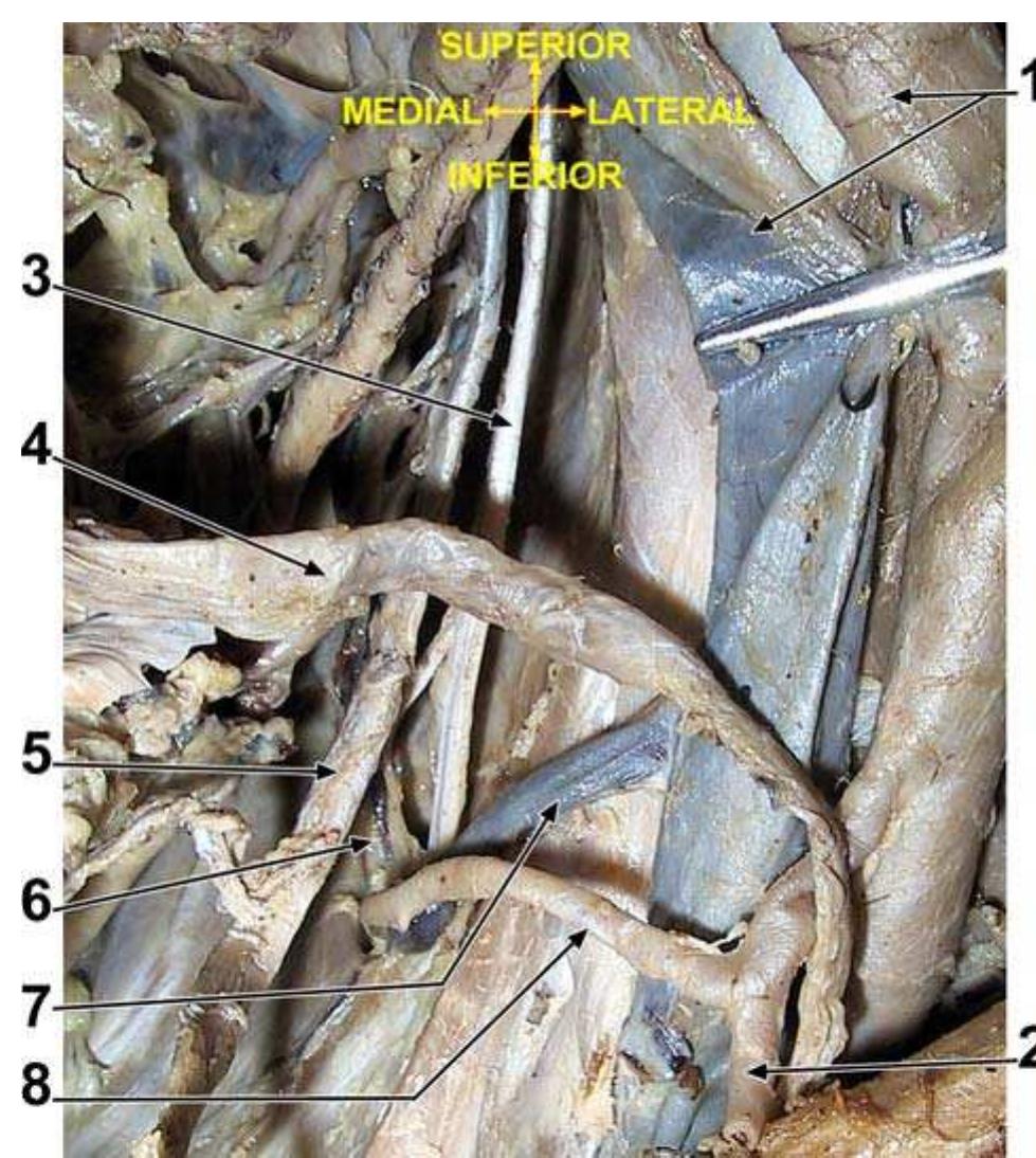 The left side, combined, arterial and venous cmor, male