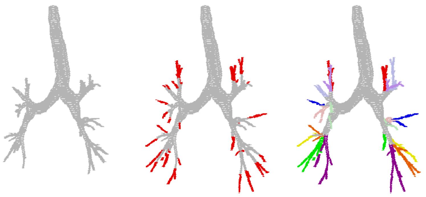 2. segmental bronchi detection. from left to right, result
