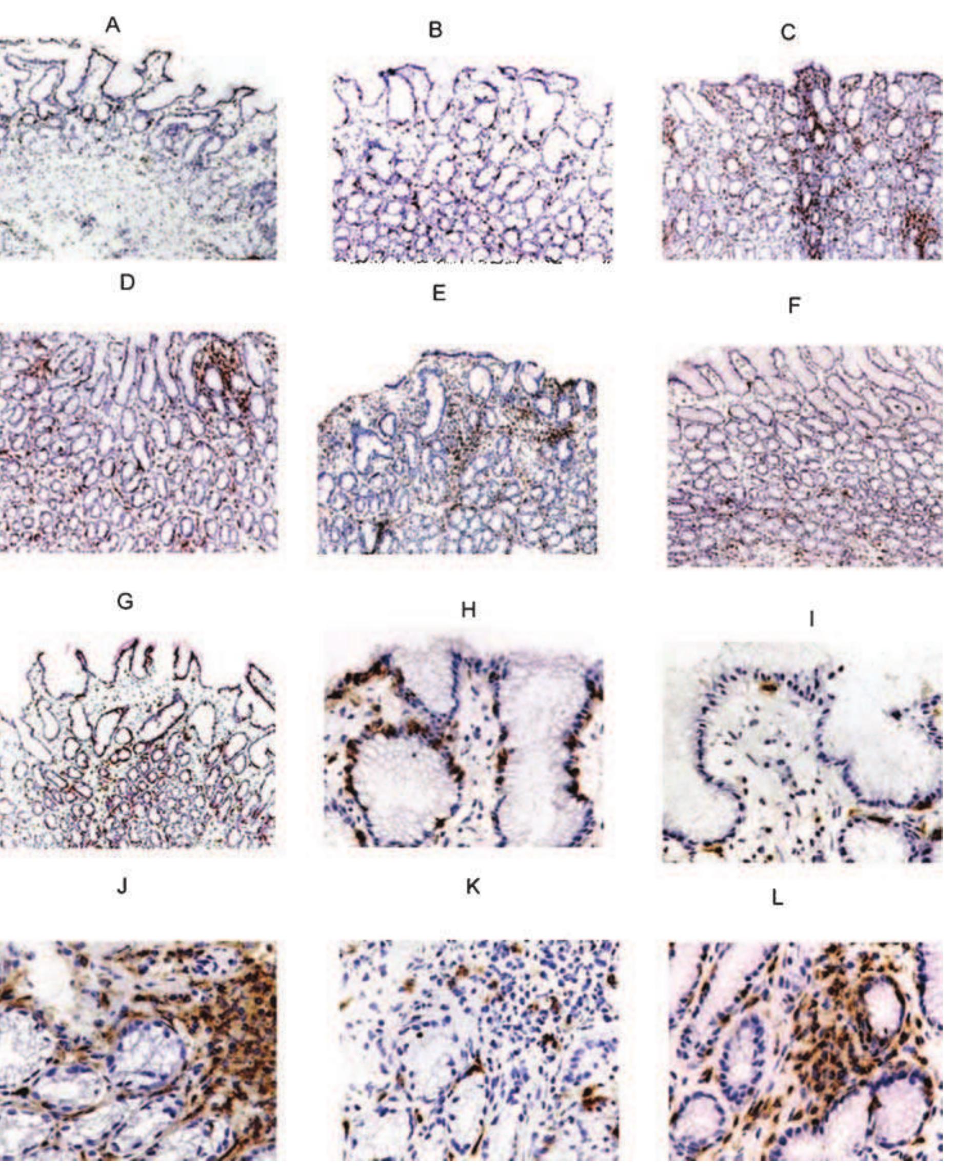 Immunohistochemical localization of mucosal lymphocytes in